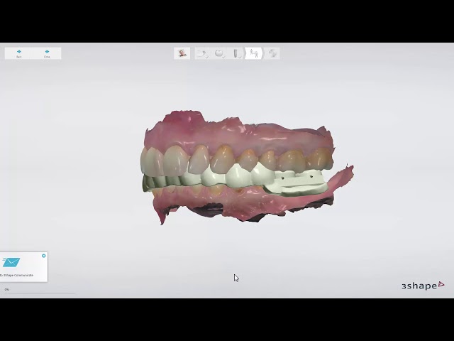 3Shape Pricing, Reviews, & Features in 2022