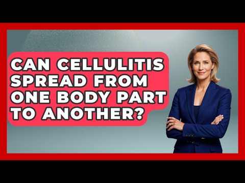 Can Cellulitis Spread From One Body Part To Another? - Skin Savvy Dermatology