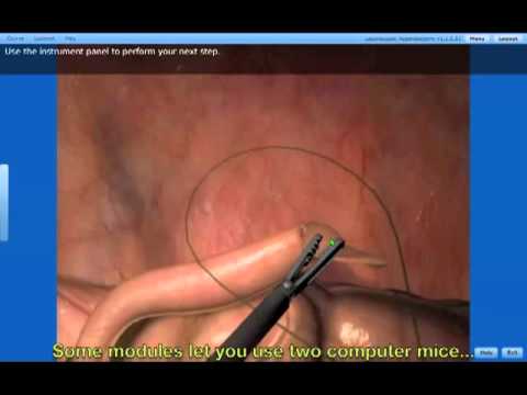 SIMTICS Medical Simulation Showcase - Laparoscopic Appendectomy