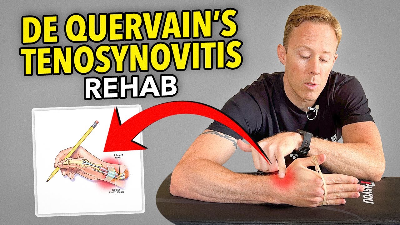 6 Exercises for De Quervain's Tenosynovitis