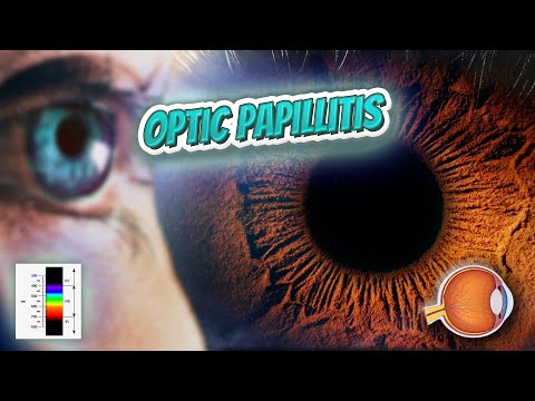 Optic Papillitis - Your EYEBALLS - EYNTK 👁️👁️💉😳💊🔊💯✅