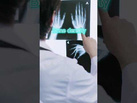 BONE DENSITY - MEDICAL DEFINITION | Medical Consecutive Interpreting