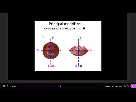 Classification of astigamatism : with the rule, against the rule and oblique axis(emmetrope part 4)