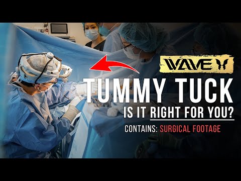 Is a Tummy Tuck right for me? A Plastic Surgeon Explains *Surgical Footage!* | Wave Plastic Surgery