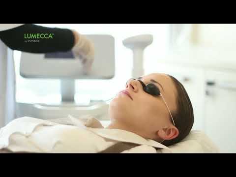 Dr Horton's "Light and Tight" (Lumeca IPL and Fractora