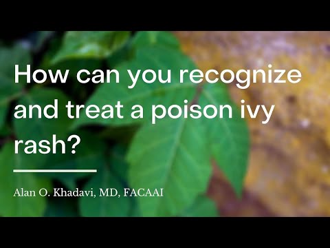 How do you recognize a poison ivy rash?