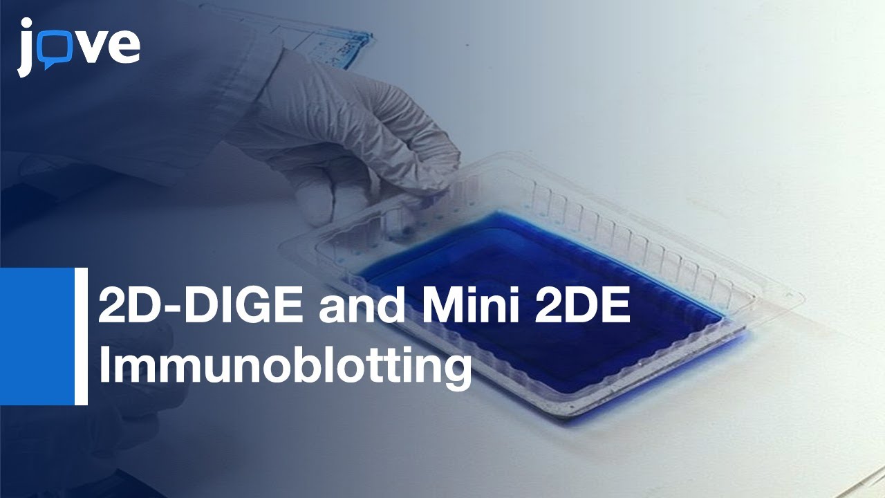 Brain Proteome Study by 2D-DIGE and Mini 2DE Immunoblotting | Protocol Preview