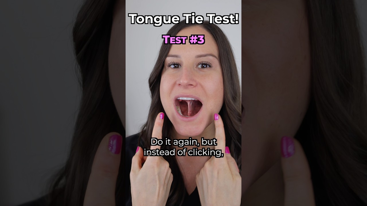 Do you have a Tongue Tie? (Quick test)