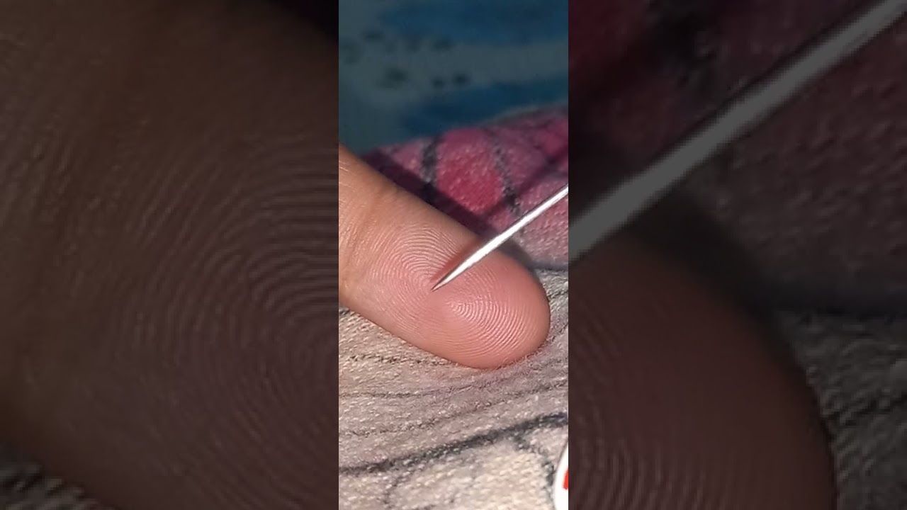 fingerprint and needle