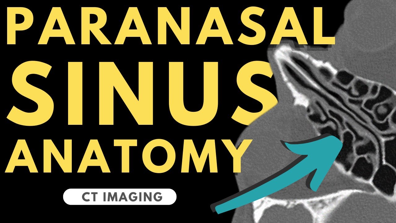 Paranasal Sinuses and Nasal Cavity | Radiology anatomy part 1 prep | CT imaging