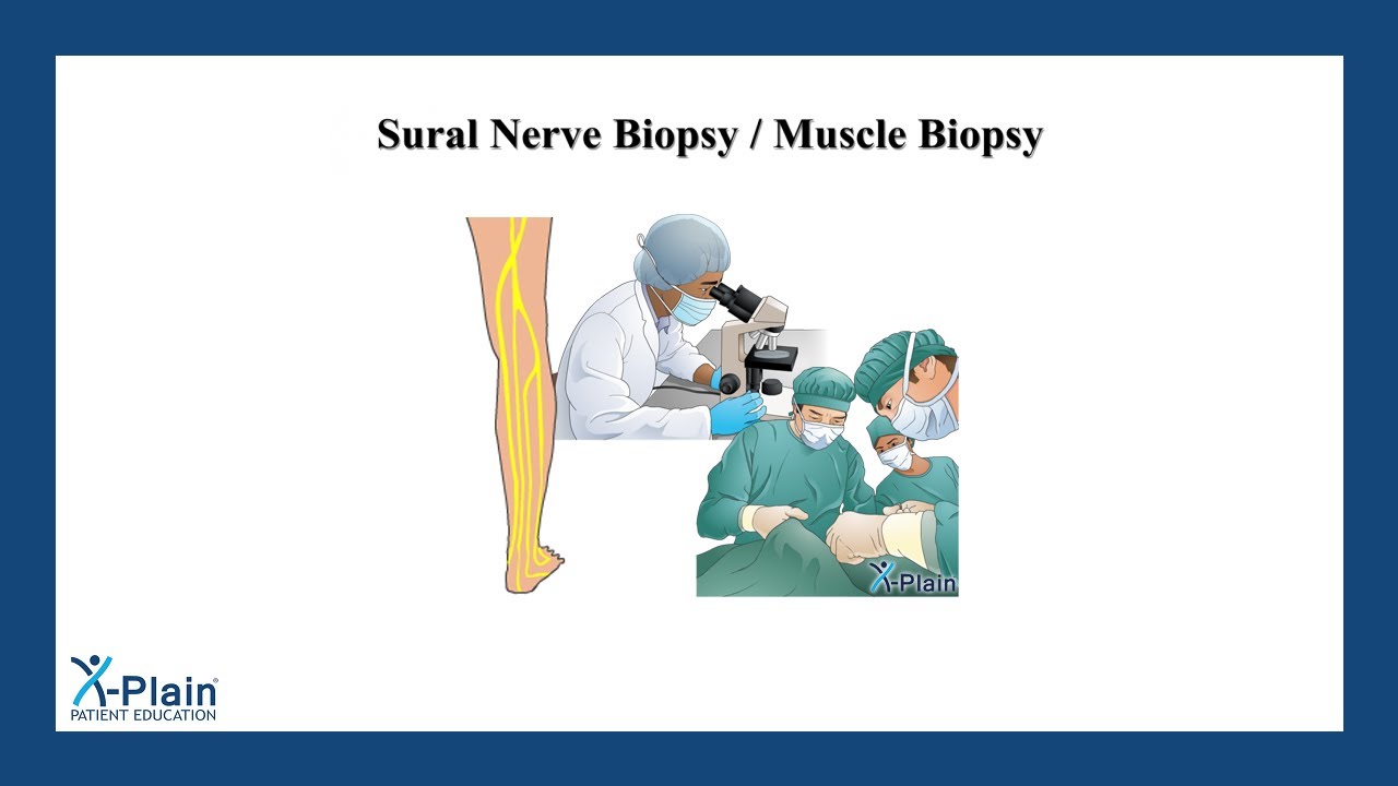 Sural Nerve Biopsy / Muscle Biopsy