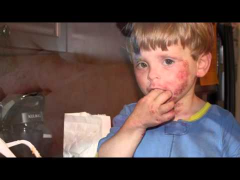 Red Skin Syndrome