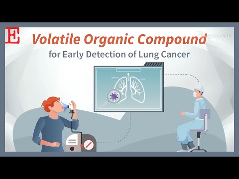 【Cancers】AI Applied to VOC Profiles for Early Detection of Lung Cancer