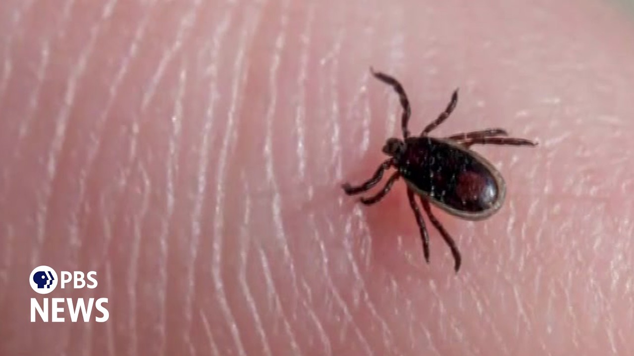 What to know about a new Lyme disease vaccine