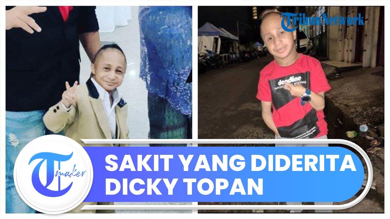 Dicky Topan "Si Entong" Meninggal Dunia, Sempat Dirawat selama 5 Hari ...
