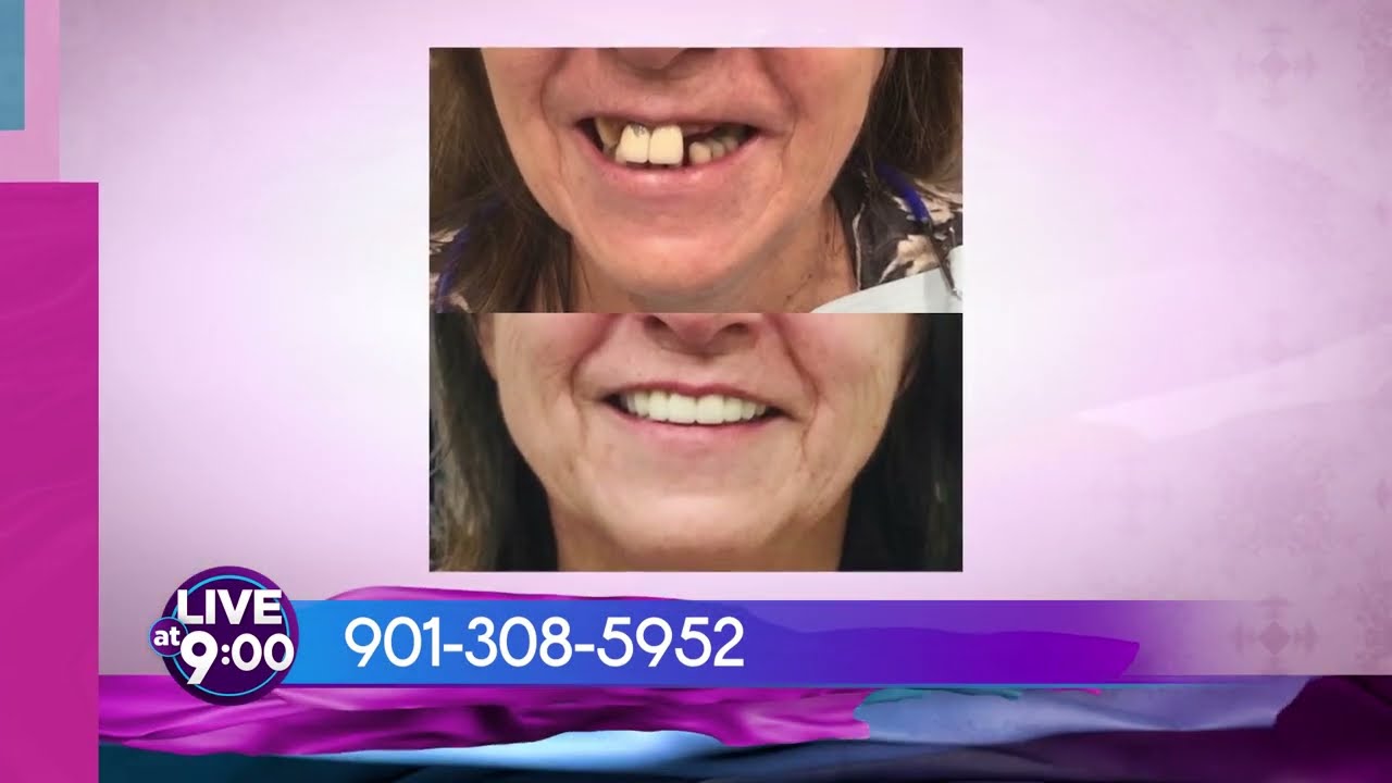 Budget-friendly dental health options with Memphis Dentures and Implants