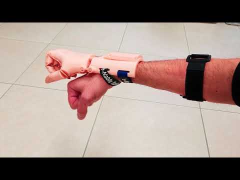 bionic hand muscle sensor by pragamichele - Thingiverse