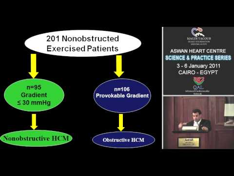 Significance of LV Outflow Tract Obstruction in HCM