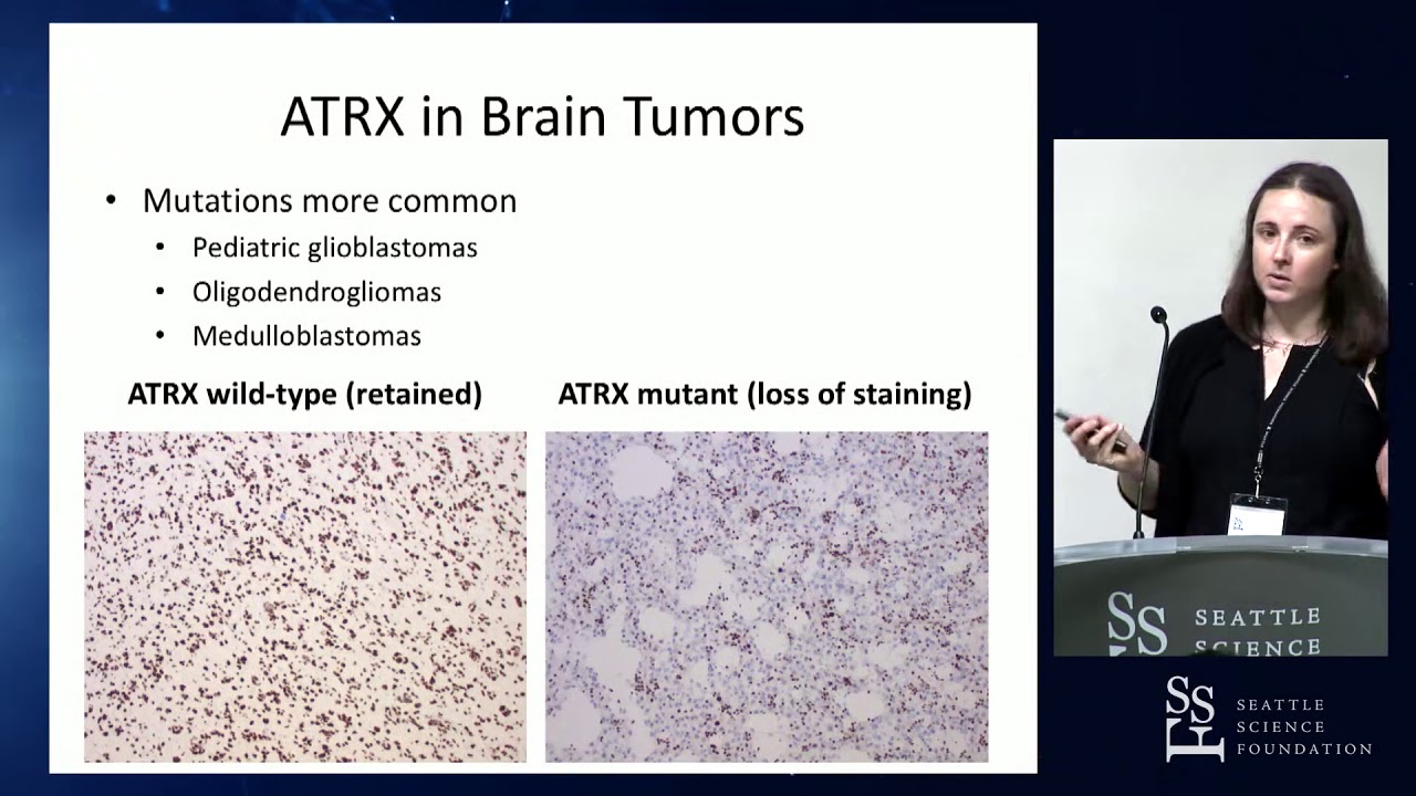 Novel Genetics and Diagnostic Criteria: Multiforme No More - Meghan Driscoll, MD