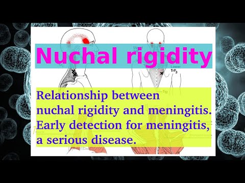 nuchal rigidity