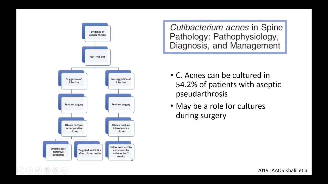 Pseudarthrosis: Risks, Work-Up, and Management - March 8, 2021 Lecture Mimi Peterson, MD