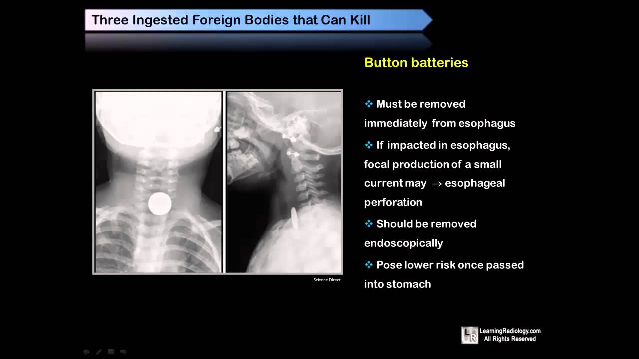 A LearningRadiology.com Top Ten Video