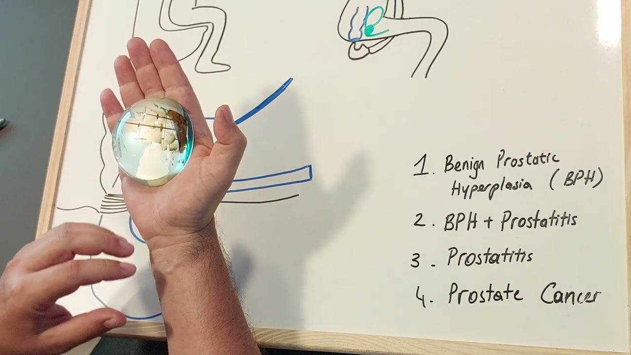 Self Prostate Massage / Examination for Men over 60