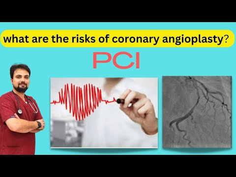 What are Risks of PCI