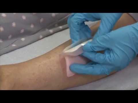 Adhesive Wound Dressing - adhesive dressing Latest Price, Manufacturers ...