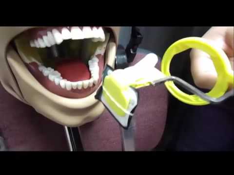 Posterior Periapical Mandibular Placement