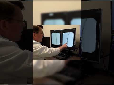 What is Interventional Radiology?
