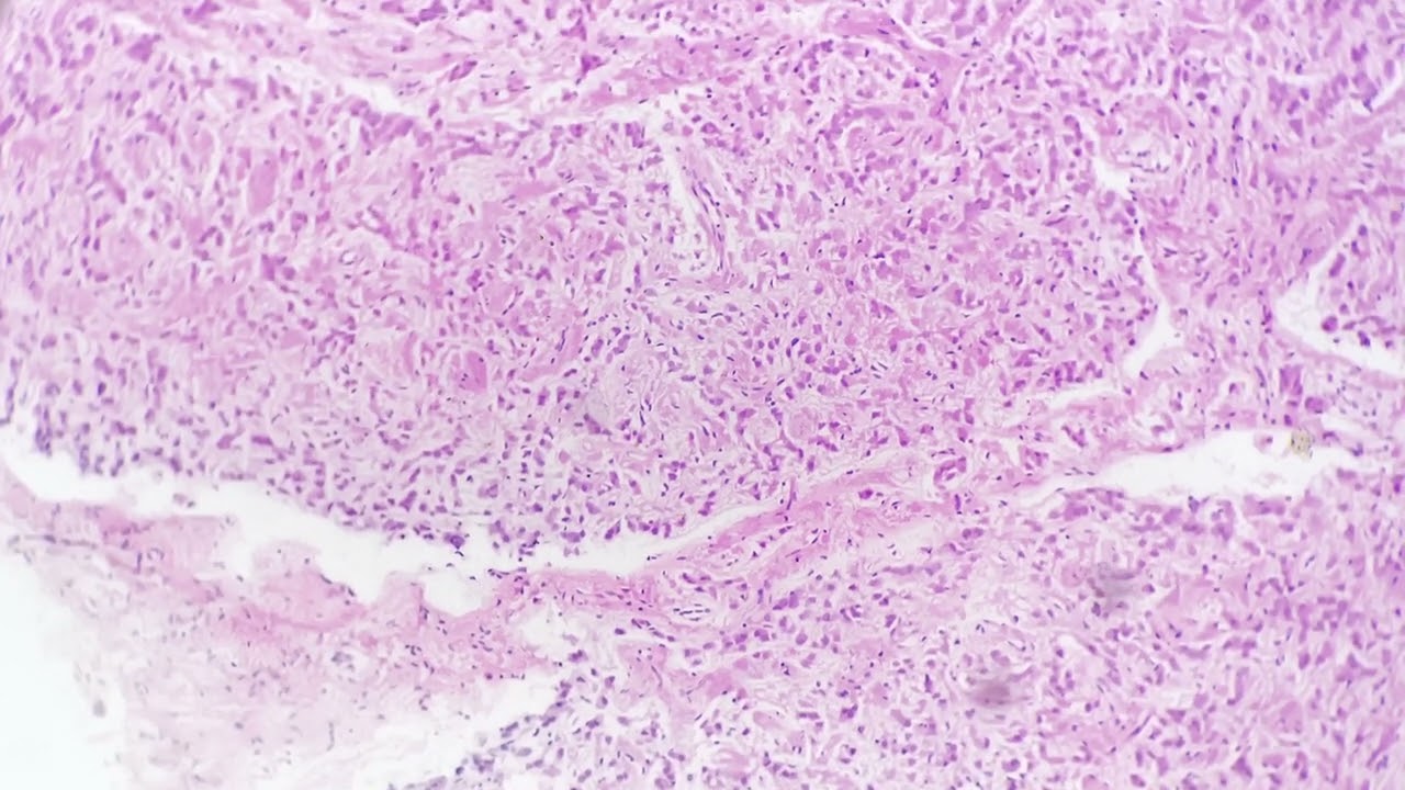 Human pineal body in section filmed under microscope with 100 times magnification on bright field