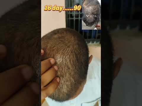 16 day use adivasi herbal hair oil and result and review #ayurvedichairoil #adivasihairoil #shorts