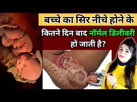 Baby Head Down Position। Baby Dropping। cephalic position of baby। Delivery | Normal Delivery