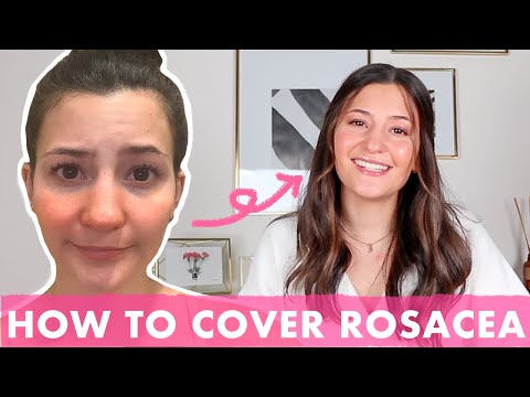 9 Makeup Products For Rosacea That Will CHANGE YOUR LIFE!