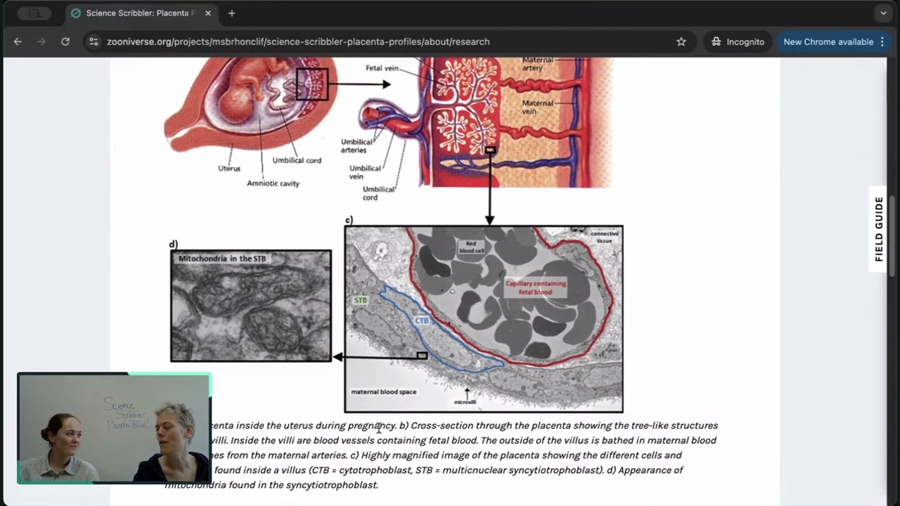 [Science Scribbler Q&A and Classify] Placenta Profiles