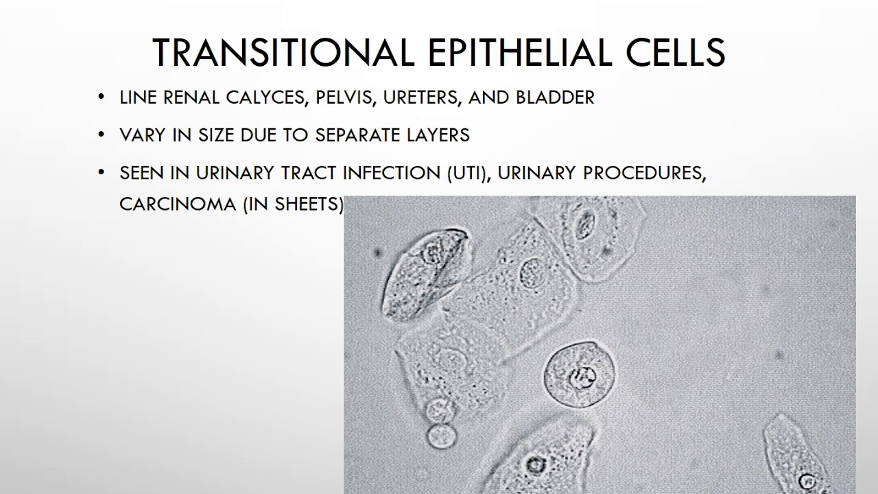 Chapter 7   Microscopic Examination of Urine