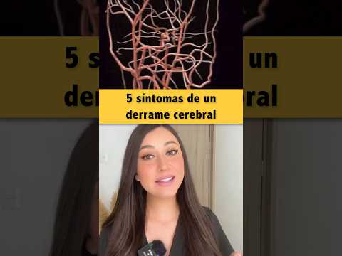 Síntomas de derrame cerebral🧠👩🏻⚕️ #salud #medicina #información #sabiasque #shorts