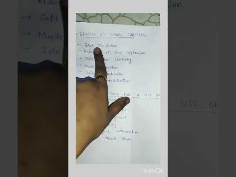 Traction - Definition, Effects, Indications, Contraindications @shubhiscoolstuff8481
