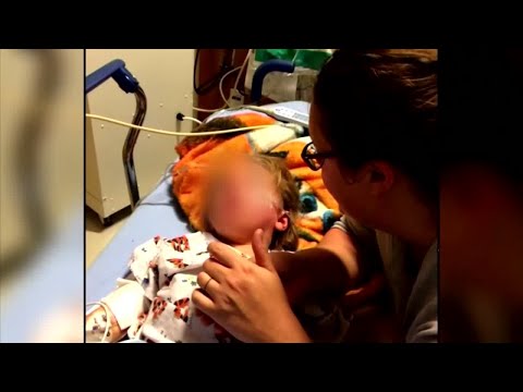 Measles spike in the United States in 20 years, UNICEF report finds