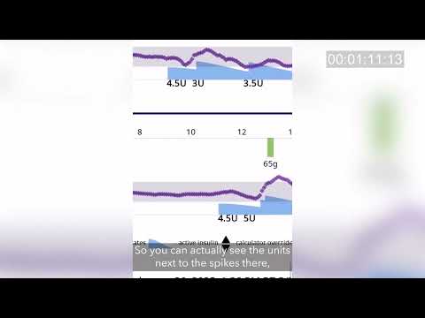 Milly explains the Smart MDI reports