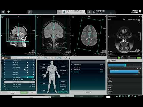 D T I MRI.(UNITED IMAGING)