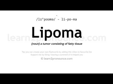 Pronunciation of Lipoma | Definition of Lipoma
