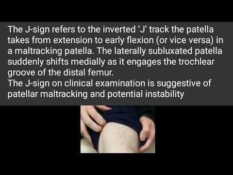 j sign importance in orthopedic#physiotherapy #orthopedics #viralshorts