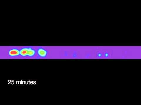 Proteins Assembling on Single-strand DNA