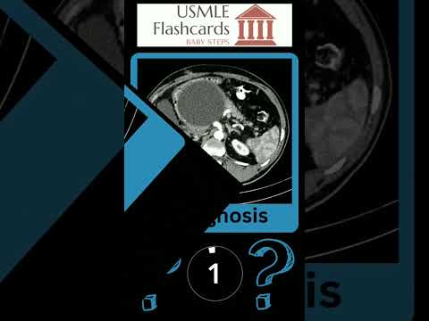 Pancreatitis complication, pseudocyst #usmle #gastrointestinal #pancreatitis #ctscan #radiology
