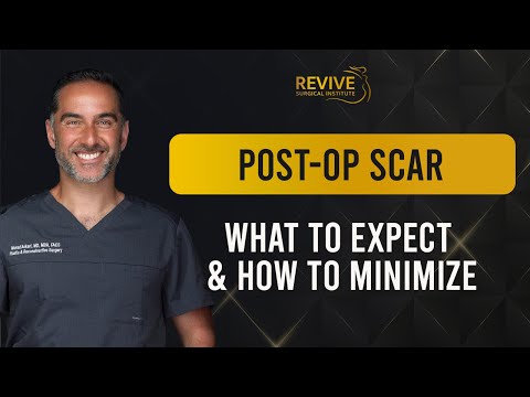 Post-Op Scarring: What to Expect and How to Minimize Scars | Dr. Askari