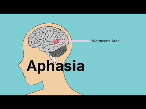 How To Pronounce Aphasia. How To say Aphasia