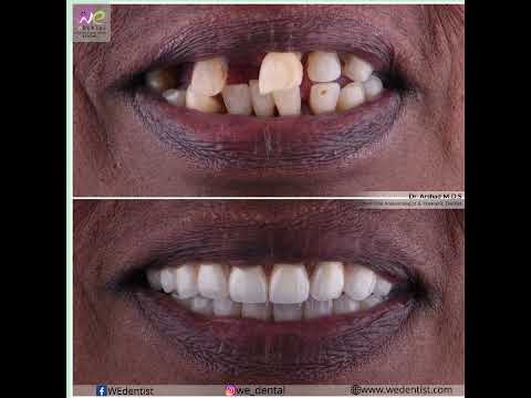 New year Vibes| Hello 2022| We Dental| Dr Arshad| Recap 2021| Make a memory| Dentistry| Coimbatore