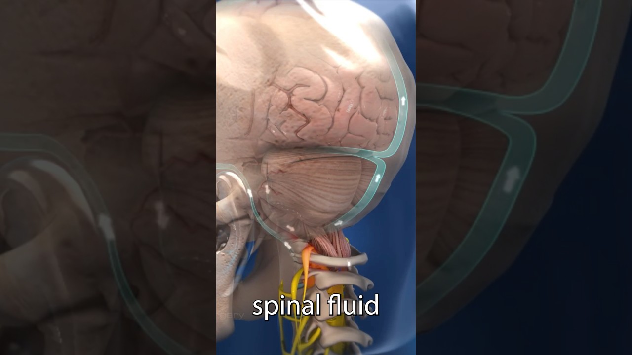 What is a Chiari Malformation?
